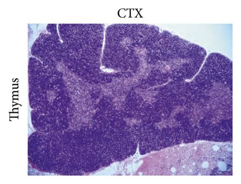Effect Of Rhcnb On He Staining Of The Thymus ×200 And Spleen ×400