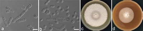 Taxonomic Revision Of Geotrichum And Magnusiomyces With The