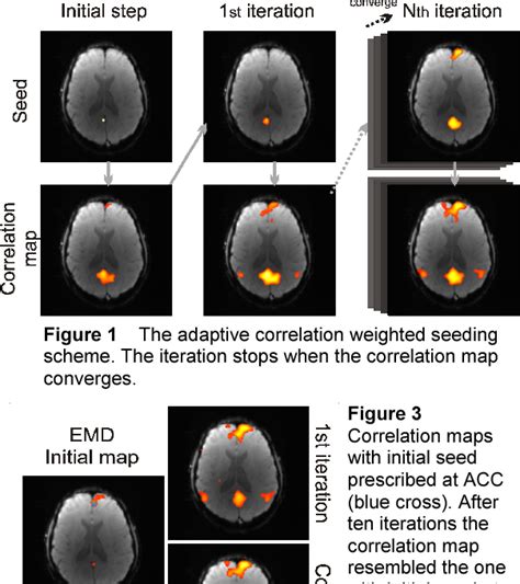 Figure 1 From Adaptive Seeding For Resting State Network Correlation