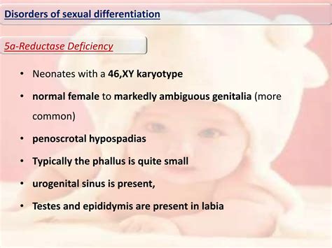 Disorders Of Sexual Differentiation Pptx