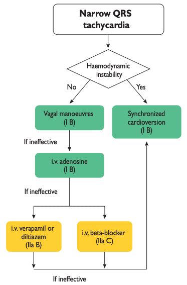 Narrow Qrs Complex
