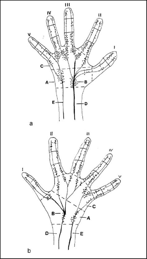 21 3 Human Hands With Mapping Of Pacinian Corpuscles There Appears To