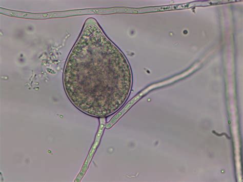 คลินิกโรคพืช มช สปอร์ของเชื้อรา Phytophthora Sp สาเหตุโรคโคนเน่าและใบไหม้ในแพงพวย Facebook