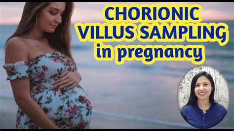 Chorionic Villus Sampling In Pregnancy What Does Chorionic Villus