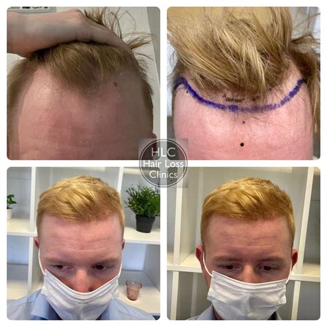 Hair Loss Specialist Clinic
