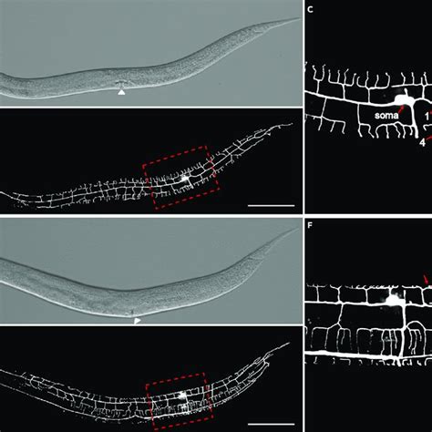 Pvd Neuron Displays An Elaborate Dendritic Arbor That Envelops The