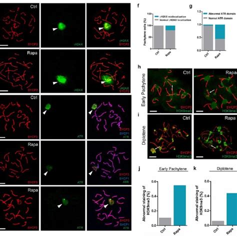 Abnormal Localization Of Sex Body Silencing Factors In Pachytene Download Scientific Diagram