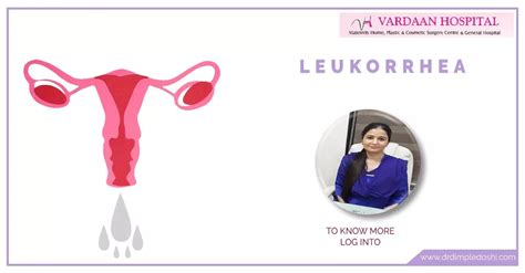 Leukorrhea Etiology Diagnosis And Treatment Of Leukorrhea