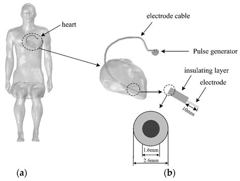 Electromagnetic Exposure Levels Of Electric Vehicle Drive Motors To Passenger Wearing Cardiac