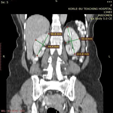 Image For Linear Dimensions Download Scientific Diagram