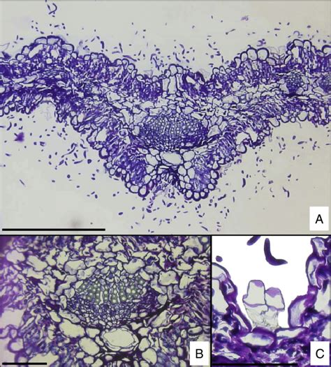 Pteronia Incana Transverse Sections Of A Leaf Showing A Secretory Duct Download Scientific