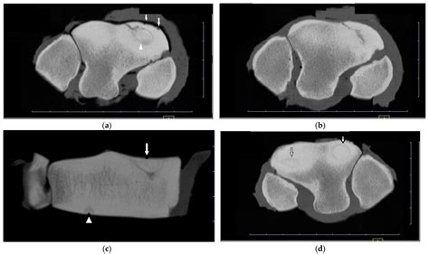 Comparison Of Radiography And Computed Tomography For Evaluation Of Third Carpal Bone Fractures
