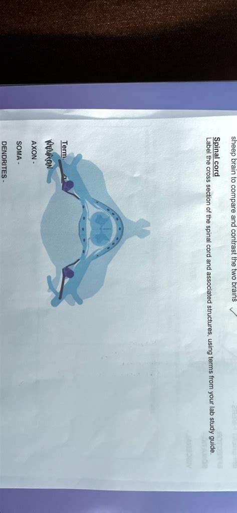 Sheep Brain To Compare And Contrast The Two Brains Spinal Cord Label