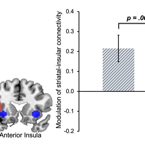 Divergent Modulation Of Ventral Striatal Left Anterior Insular
