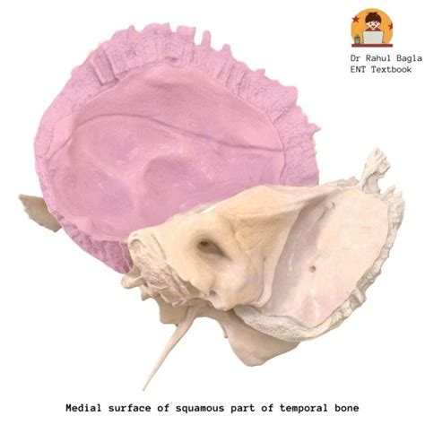 Anatomy Of Temporal Bone Best Anatomy Notes Lecture Ppt Pdf