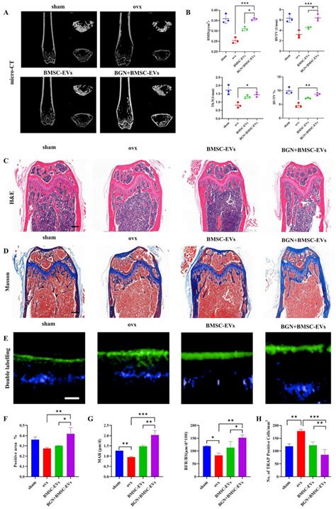 The Inhibitory Impact Of Bgn Bmsc Evs On Bone Resorption In Vivo A Download Scientific