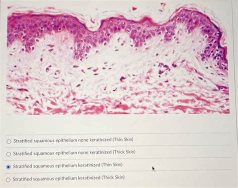 Stratified Squamous Epithelium Keratinized Skin
