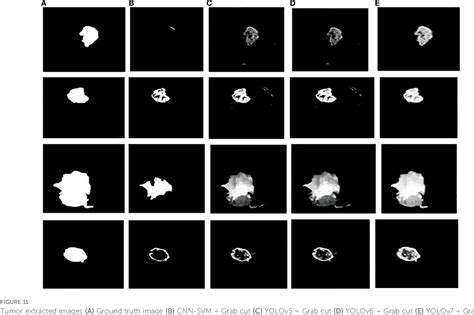 Figure 1 From A Deep Learning Model For The Localization And Extraction