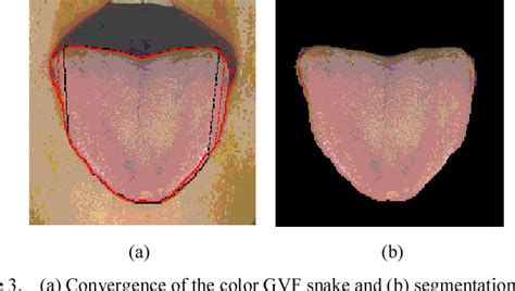 Figure 3 From Color Active Contour Models Based Tongue Segmentation In Traditional Chinese