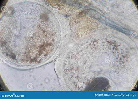 Parasitic Helminths Trematodes Of Marine Fishes Under A Microscope