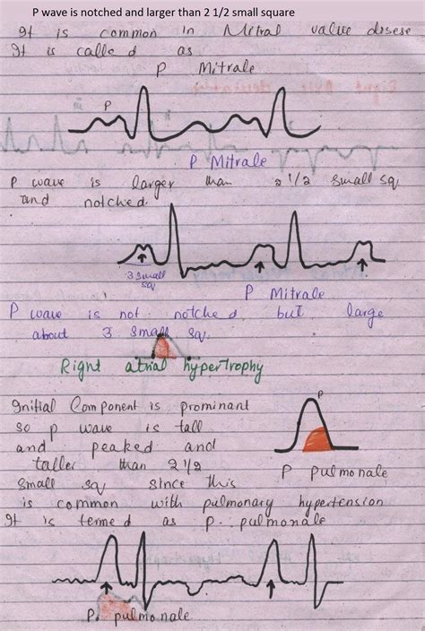 Ecg Handwritten Notes 1 File Download