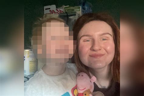 Woman Forced To Shave Her Whole Head Over Hair Extensions Mishap Bald In 4 Weeks After Bleeding