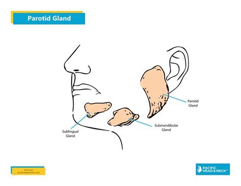 Parotid Gland Tumors Pacific Head Neck Artofit