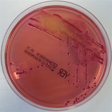 Xld Agar Yersinia Entercolitica Xld Agar Xylose Lysine Deoxycholate