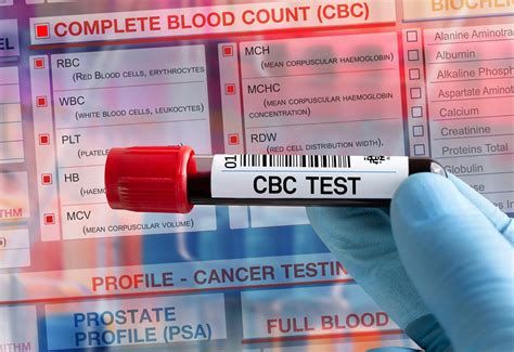 How Much Is A Tb Test Without Insurance Livewell