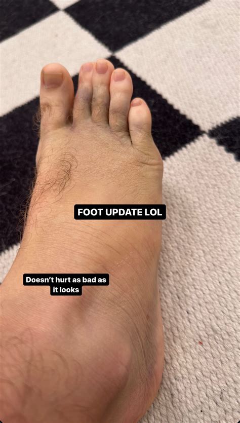 Nick Noonans Feet