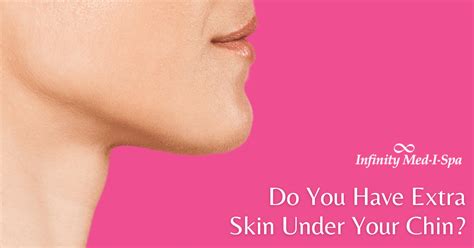 Extra Skin Under Chin