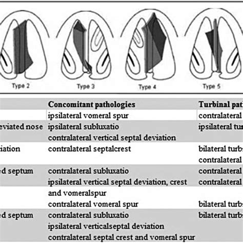 Six Types Of Nasal Septal Deviation Baumann Et Al 2007 10 Download Scientific Diagram Six Types Of Nasal Septal Deviation Baumann Et Al 2007 10 Download Scientific Diagram