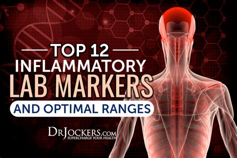 Top 12 Inflammatory Lab Markers And Optimal Ranges