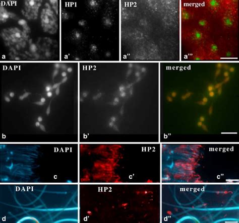 P Citri Spermatogenesis Hp2 Immunostaining Pattern First Row In All