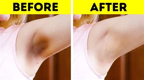 41 Beauty Hacks To Make You Prettier Youtube
