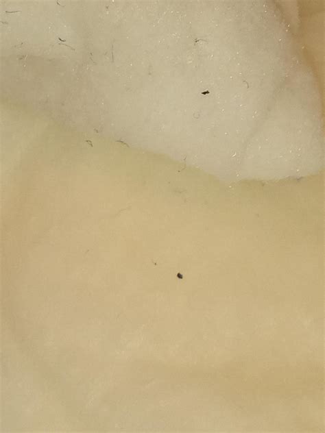 Tiny Black Specks Everywhere Please Help Rwhatisthis