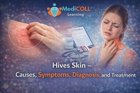 Hives Skin Causes Symptoms Diagnosis And Treatment