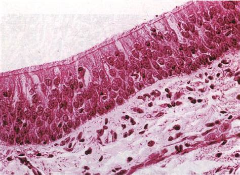 图8 6 支气管 病理组织