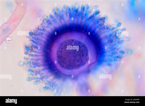 Aspergillus Fungus Light Micrograph Of A Section Through A Sporangium From An Aspergillus Sp
