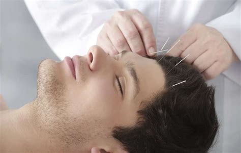 Acupuncture Outperforms Drug For Insomnia Relief Acupuncture Sligo