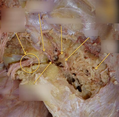 Gross Anatomy Middle Ear Dissection Diagram Quizlet