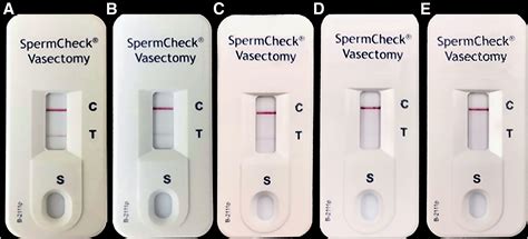Male Contraception Development Monitoring Effective Spermatogenesis