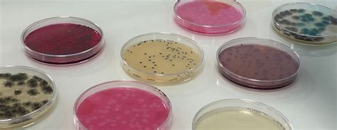 Biokar Diagnostics Expert En Diagnostic Microbiologique