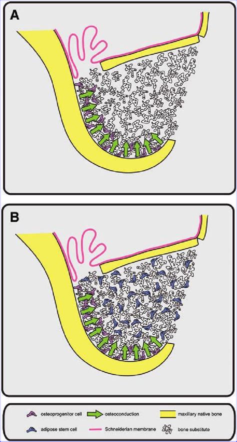 Schematic Figure Of The Msfe Procedure A Msfe Is Performed Via A