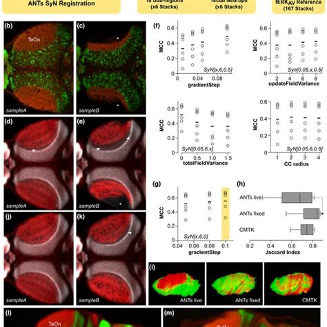 Optimization Of Ants Registration Parameters For Fixed Tissue A