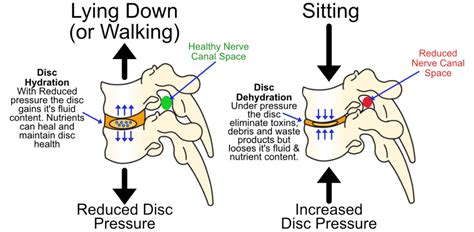Maintaining Disc Health Back Care Clinic