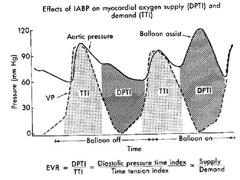 Iabp Principle Hemodynamic Timing Weaning 2016 Background Asmiha