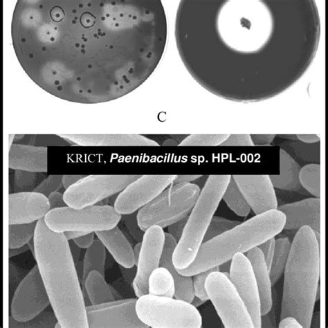Screening Of Xylan Degrading Bacteria A And Isolation Of