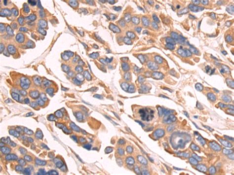 兔抗tuba1c多克隆抗体anti Tuba1c Rabbit Polyclonal Antibody 生命科学产品与技术服务 生工生物工程