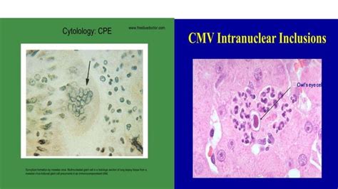 Cytopathic Effect Notes By Sanju Sahpptx